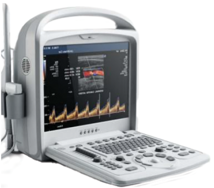 Portable Color Doppler - KS International Pvt. Ltd.